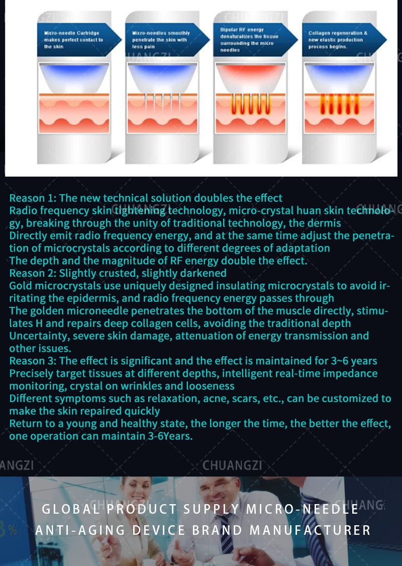 【New Arrival】 RF Microneedling Machine Stretch Mark Remover Fractional ...